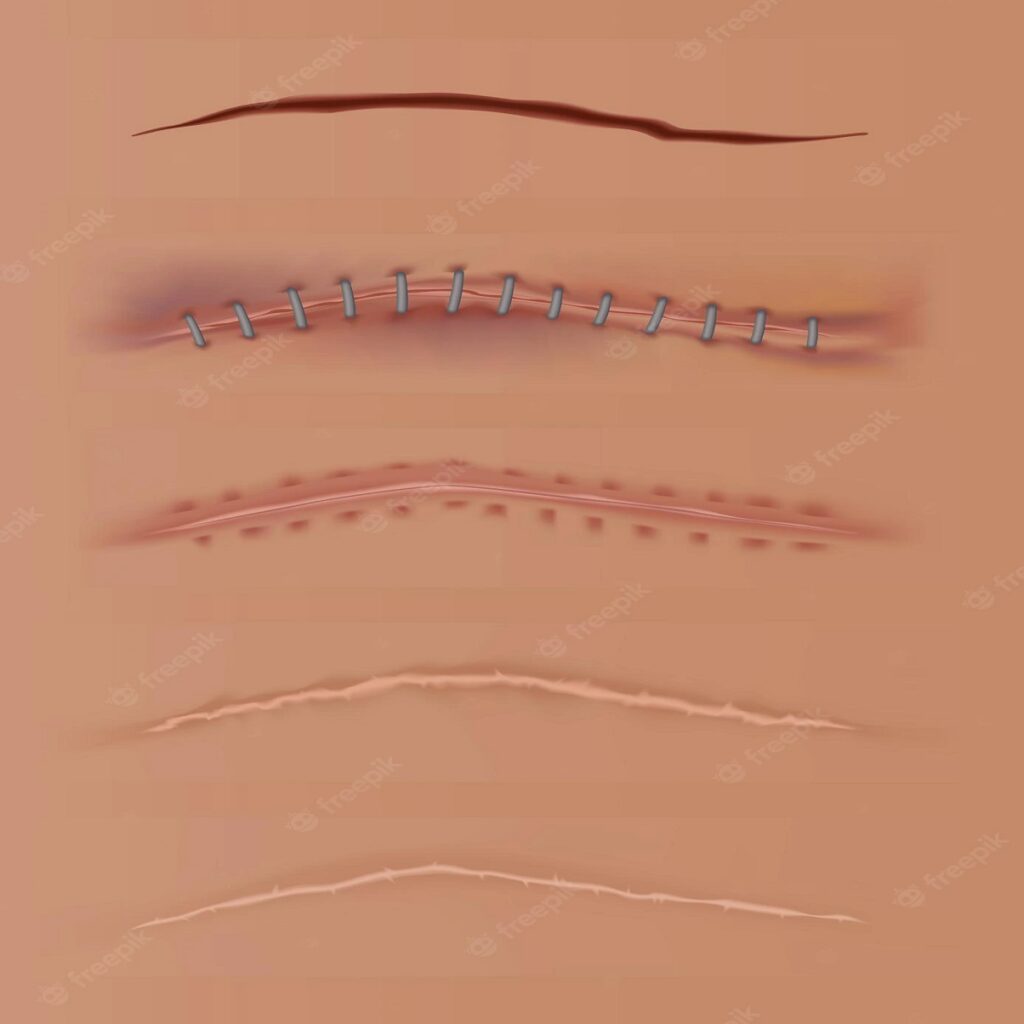 Women's Clinic BTM – Dr Brunda Channappa – Best Gynaecologist ...