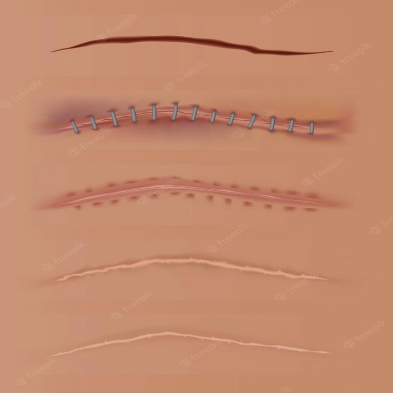 Women's Clinic BTM – Dr Brunda Channappa – Best Gynaecologist ...